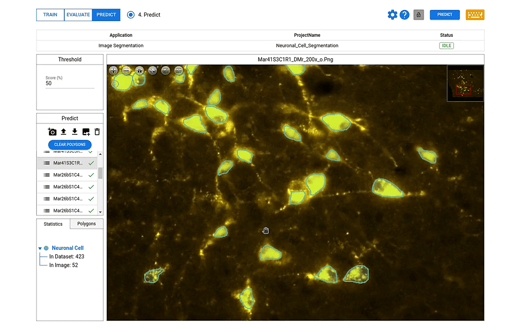 Cytoplasm Segmentation in High-Resolution Microscopy with Deep Block